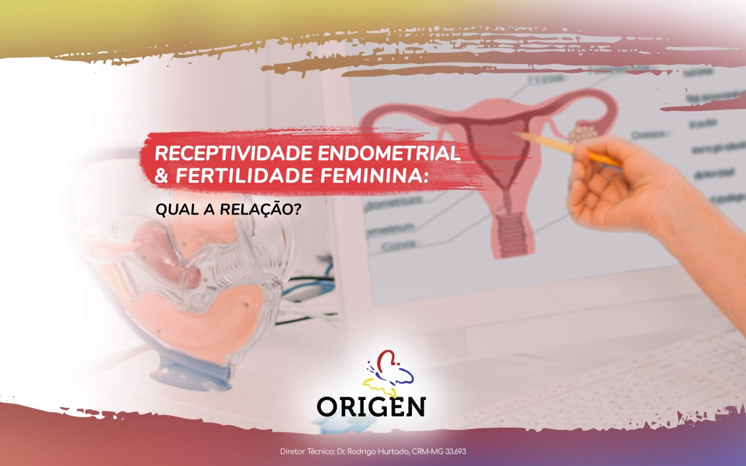 Receptividade Endometrial E Fertilidade Feminina Qual A Relação