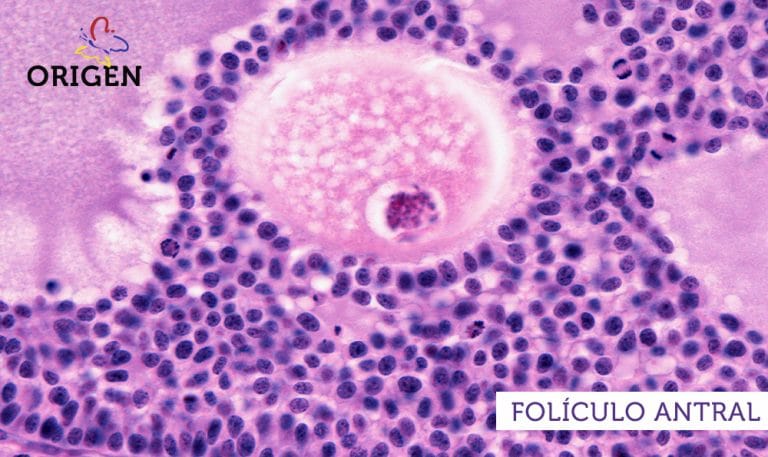 O que é folículo antral? » Clínica Origen | Fertilização in Vitro