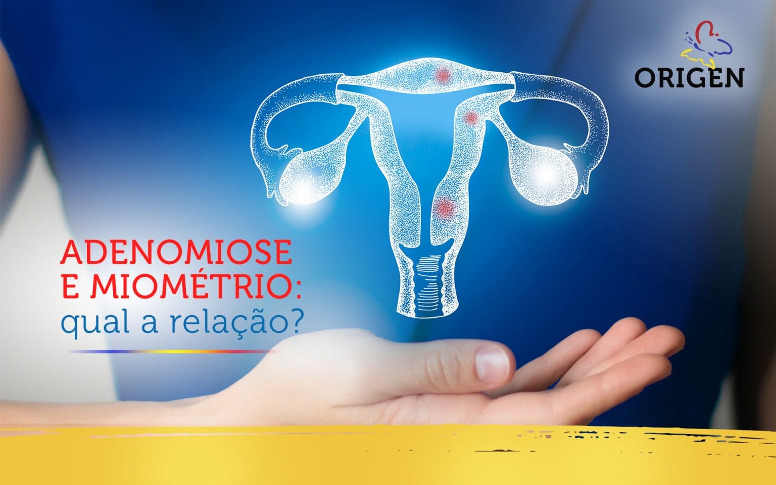 Adenomiose e miométrio: qual é a relação? » Clínica Origen ...