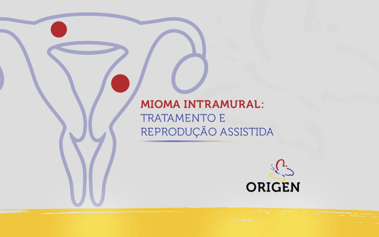 Mioma intramural: tratamento e reprodução assistida » Clínica Origen ...