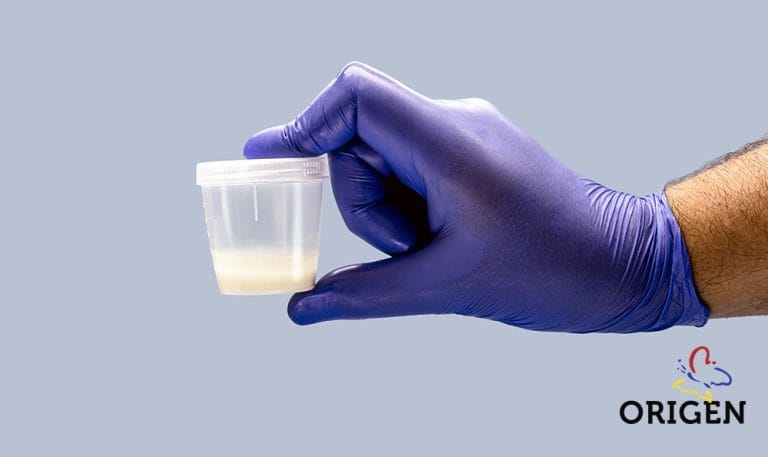 Espermograma com morfologia de Krüger: o que é? » Clínica Origen ...